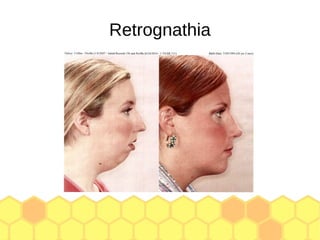 Pre operative assessment | PDF