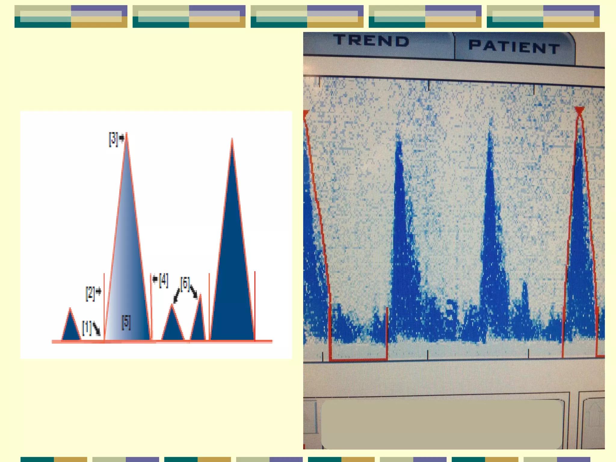 Pre operative, non-invasive cardiac output measurement | PPT
