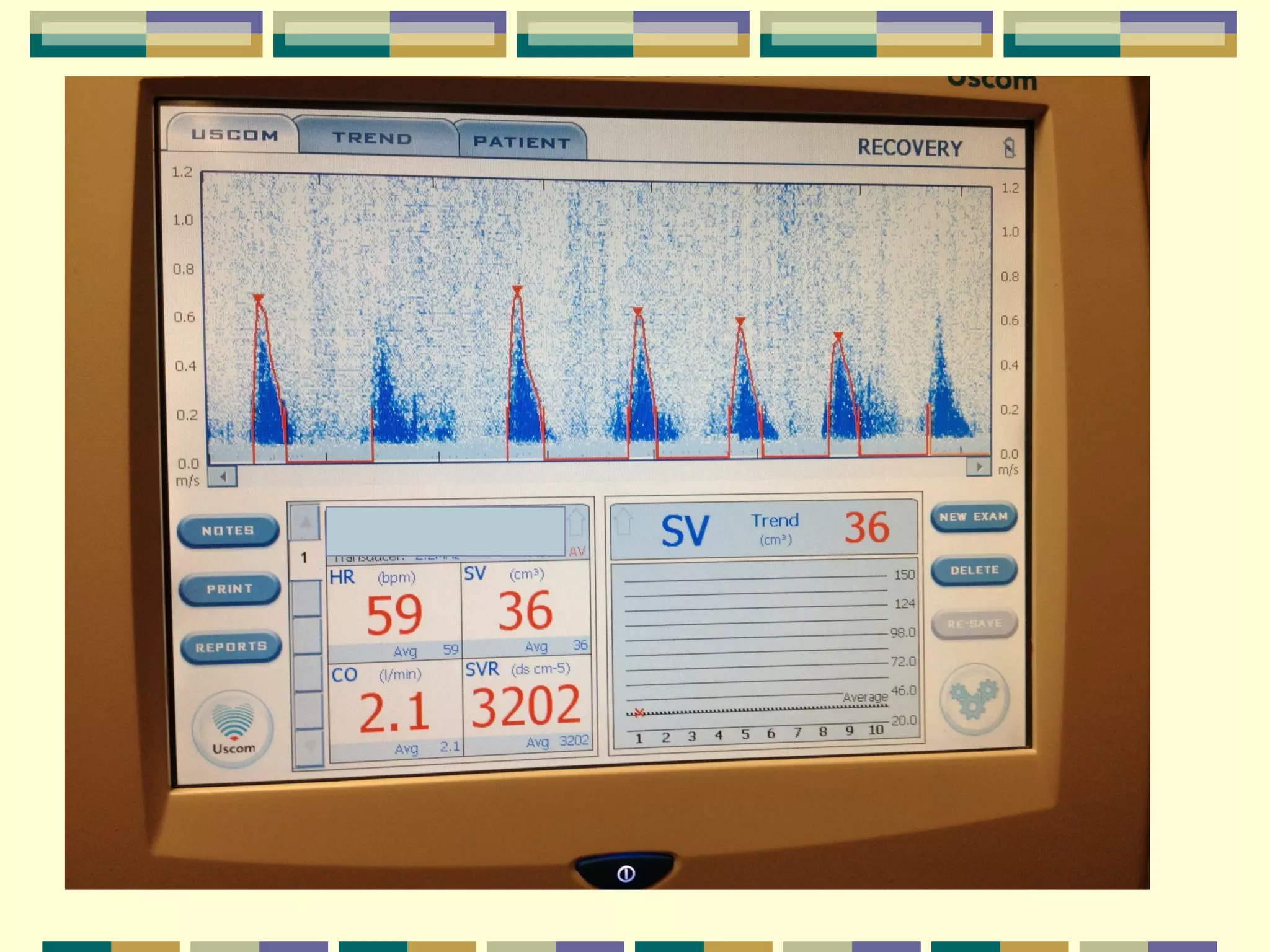 Pre operative, non-invasive cardiac output measurement | PPT
