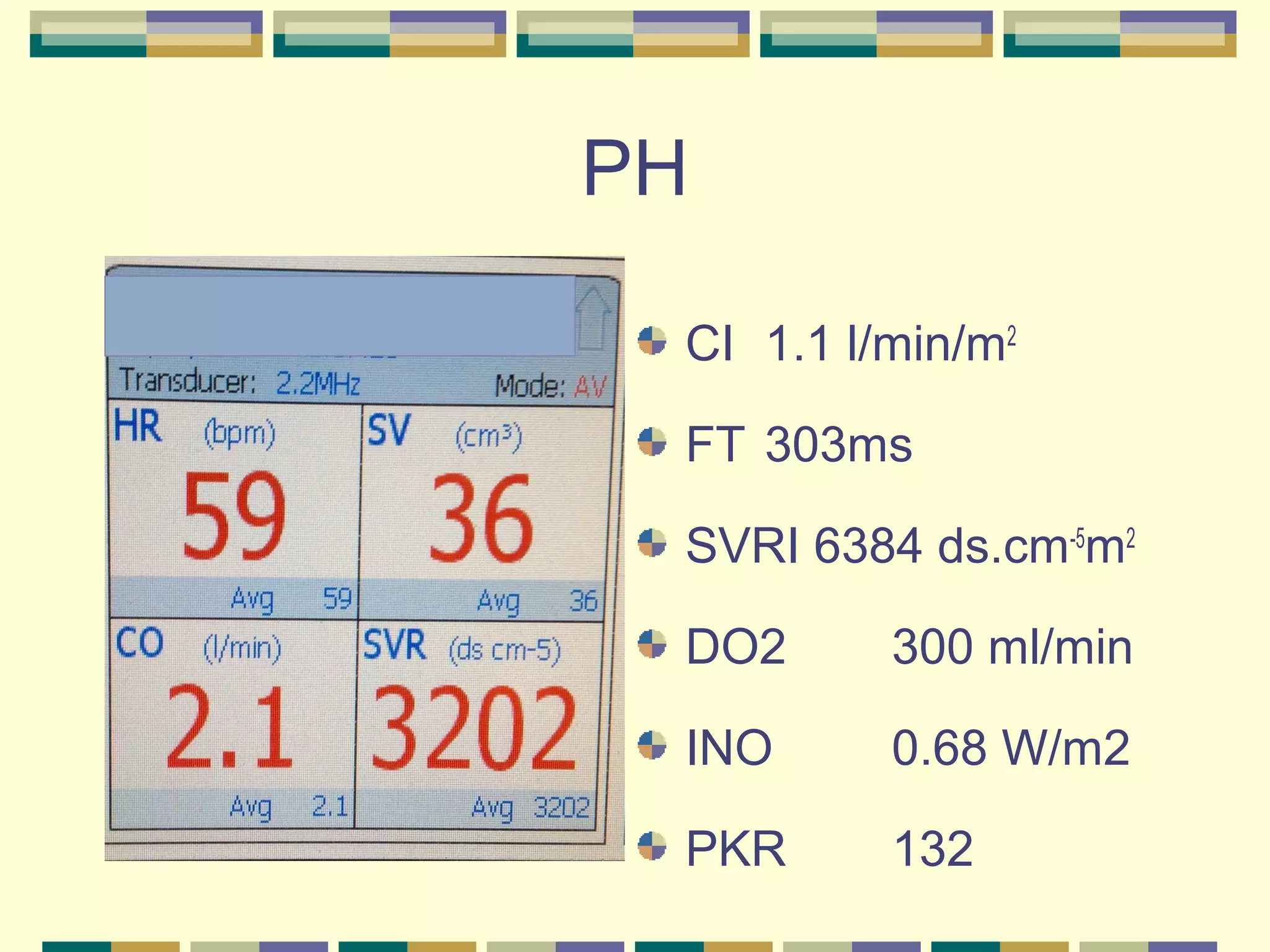 Pre operative, non-invasive cardiac output measurement | PPT