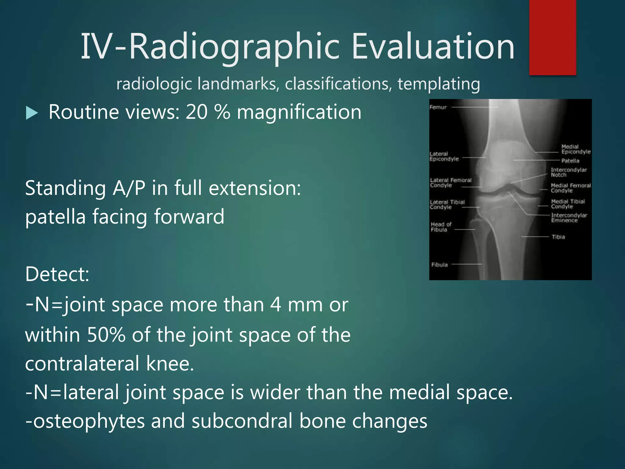 Preoperative preparation of total knee arthroplasty | PPTX