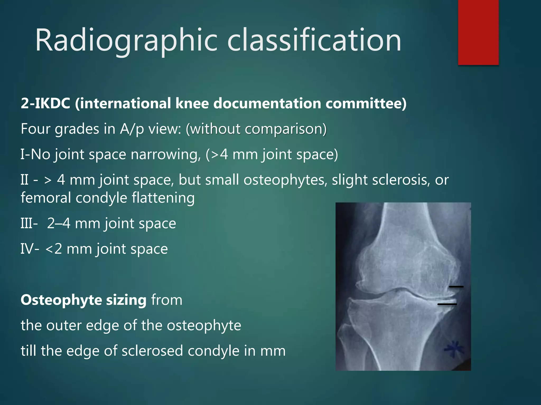 Preoperative preparation of total knee arthroplasty | PPTX