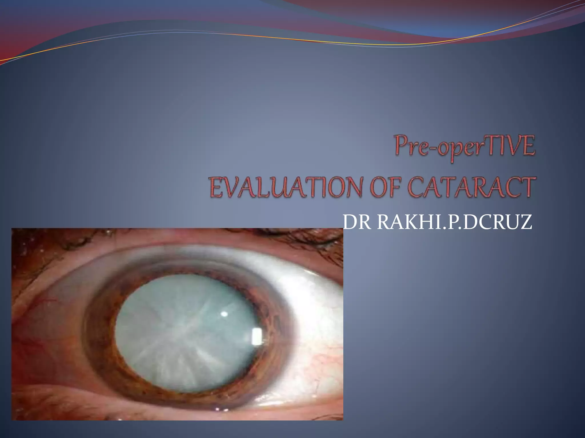 Pre operative analysis for cataract surgery | PPTX