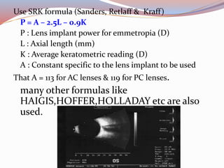 Pre operative analysis for cataract surgery | PPTX