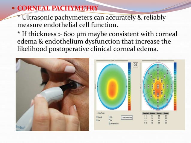 Pre operative analysis for cataract surgery | PPTX | Eye and Vision ...