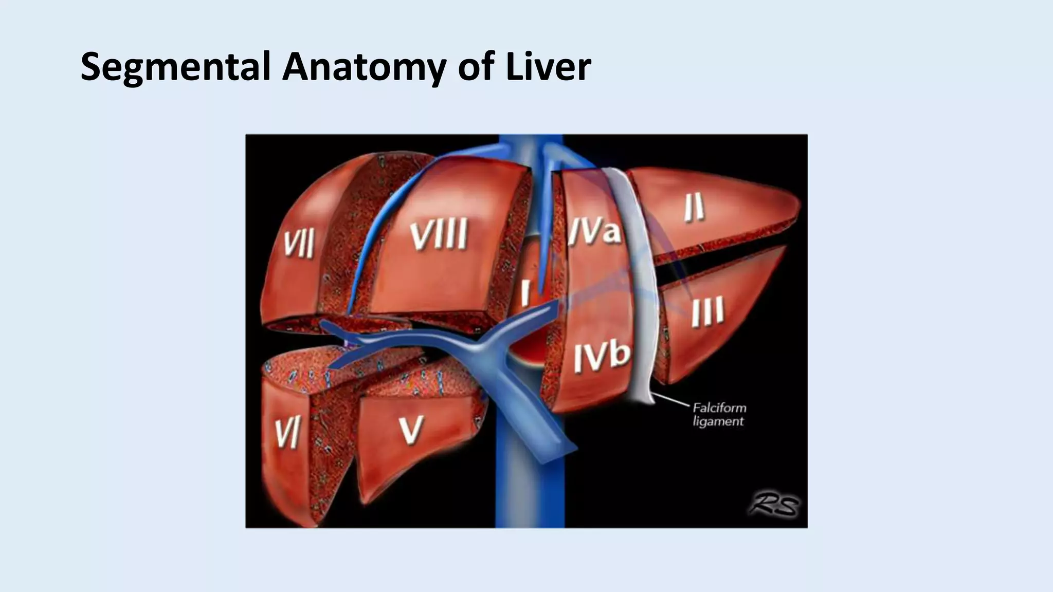 Pre-operative liver transplant imaging | PPTX