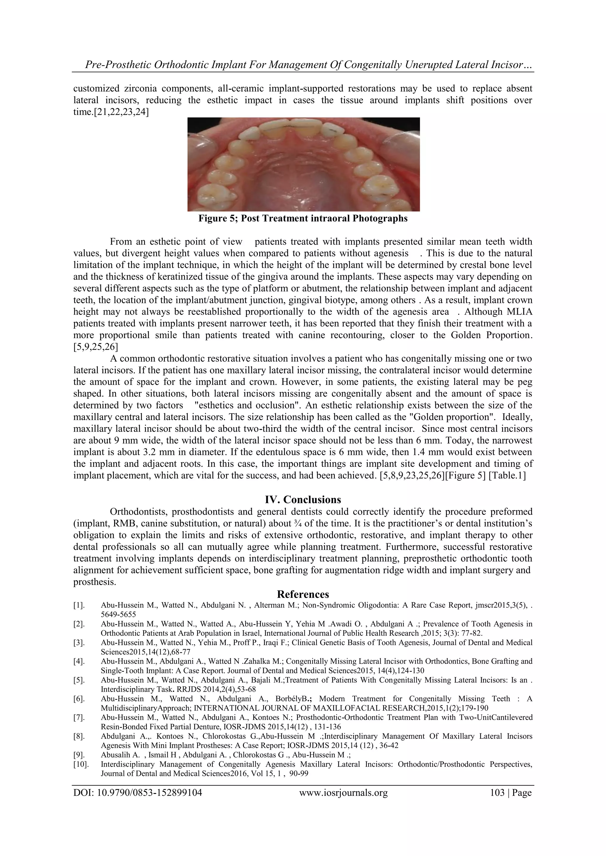 Pre prosthetic orthodontic implant for management of congenitally ...