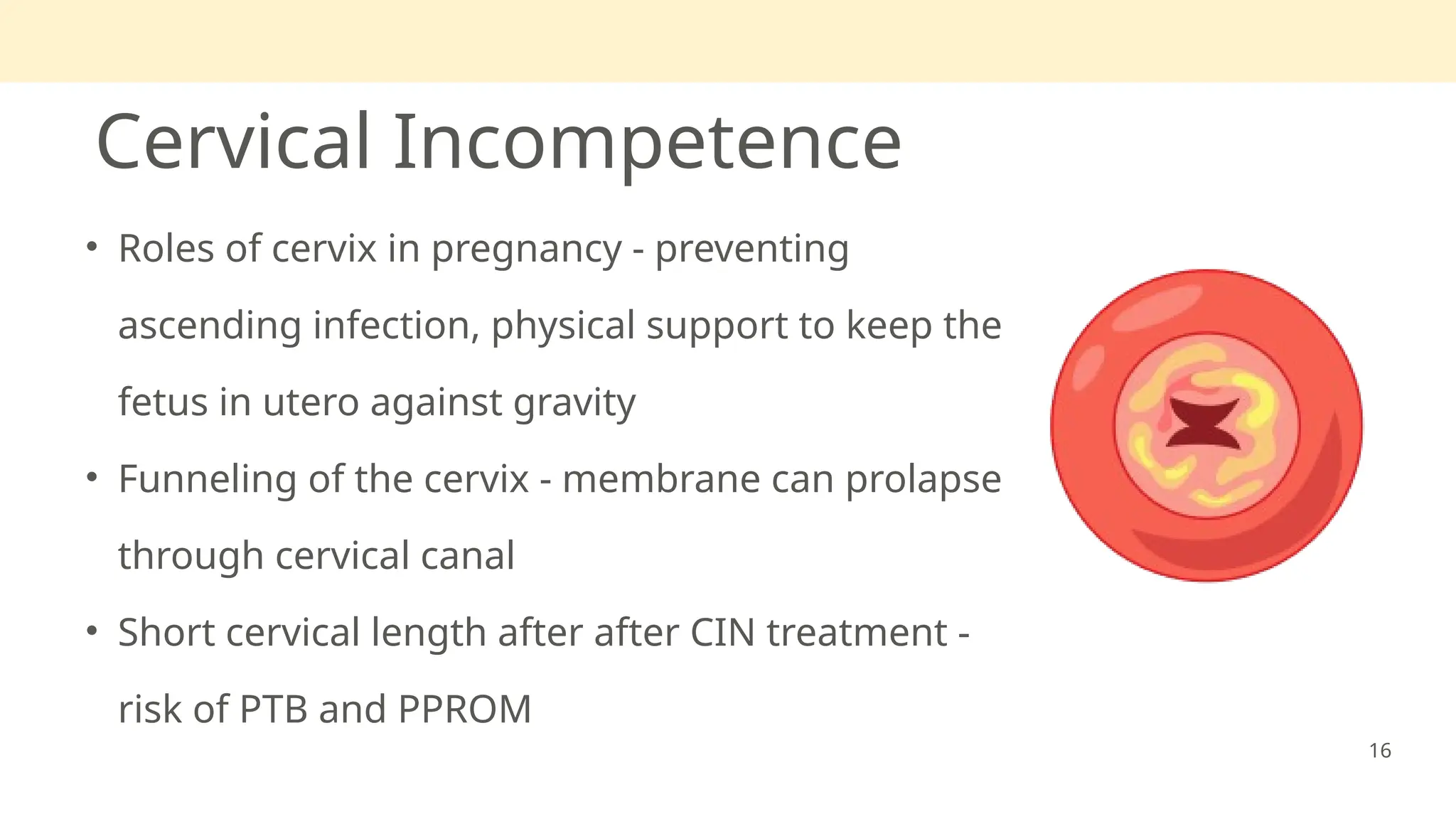 Pre-Term Labour and PPROM Risk Factors, Incidence, Pathophyisology ...