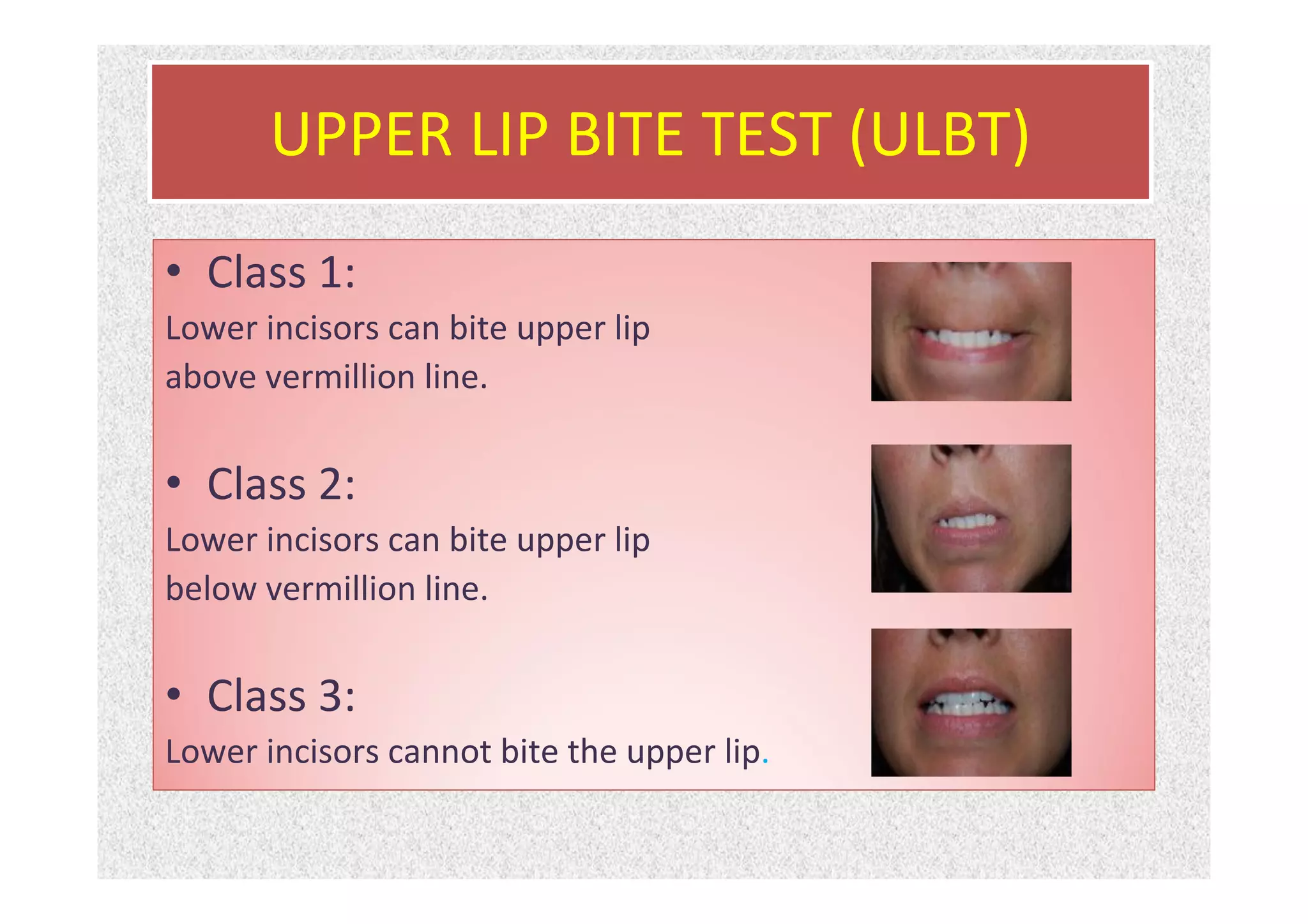 Pre anaesthetic evaluation.pdfx | Blood Disorders | Diseases and Conditions