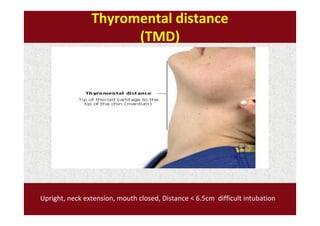 Pre anaesthetic evaluation.pdfx | Blood Disorders | Diseases and Conditions