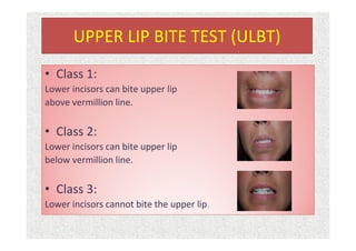 Pre anaesthetic evaluation.pdfx