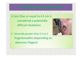 Pre anaesthetic evaluation.pdfx