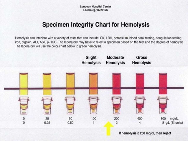 Pre analytical in lab testing | PPTX | Blood Disorders | Diseases and ...