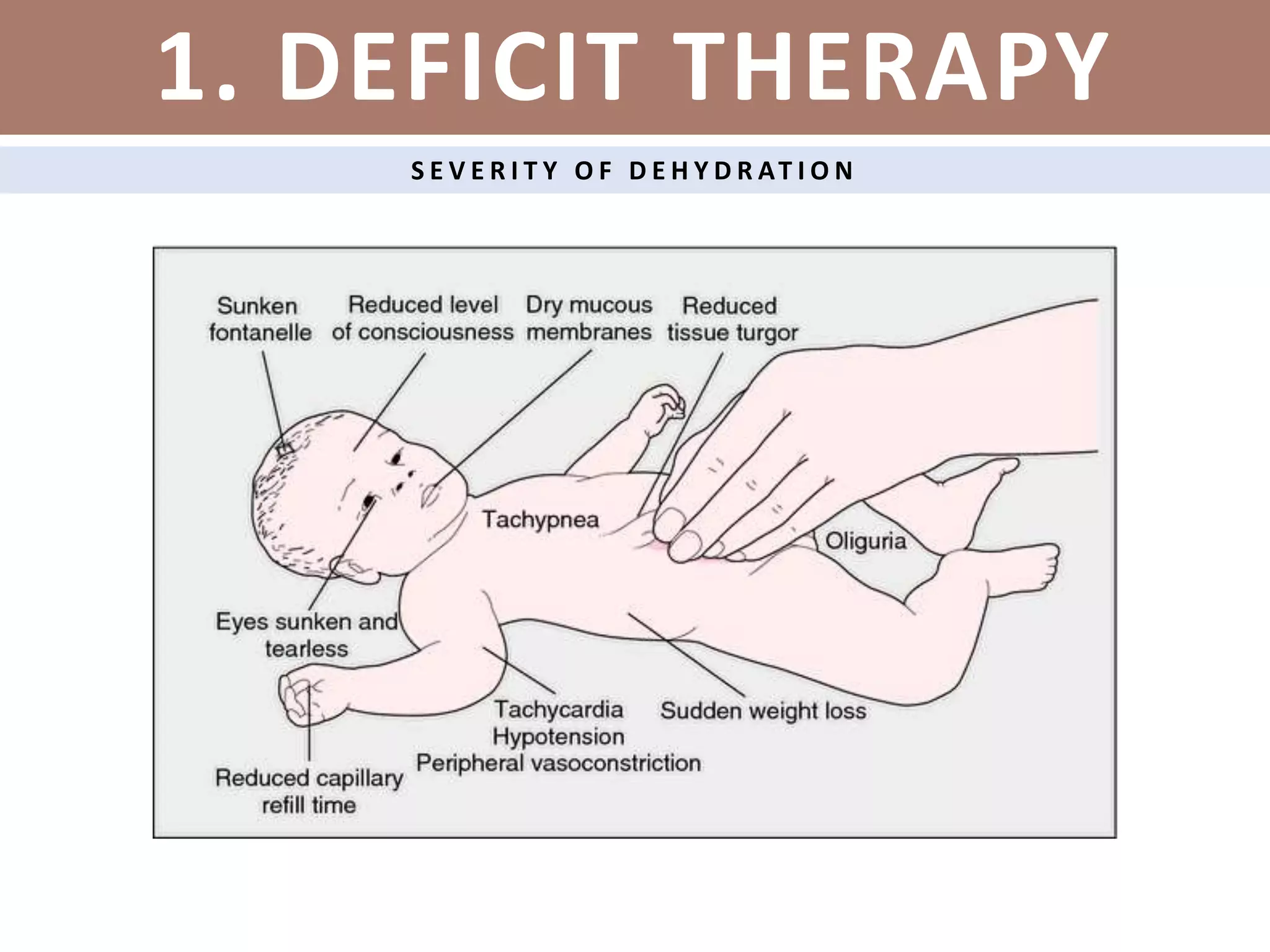 Pre and Post operative in Paediatric Surgery | PPTX