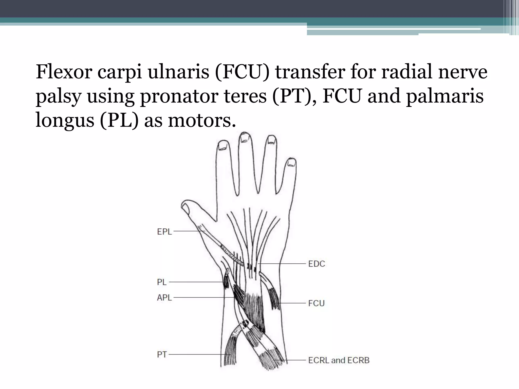 Pre and post operative management in tendon transfer | PPTX