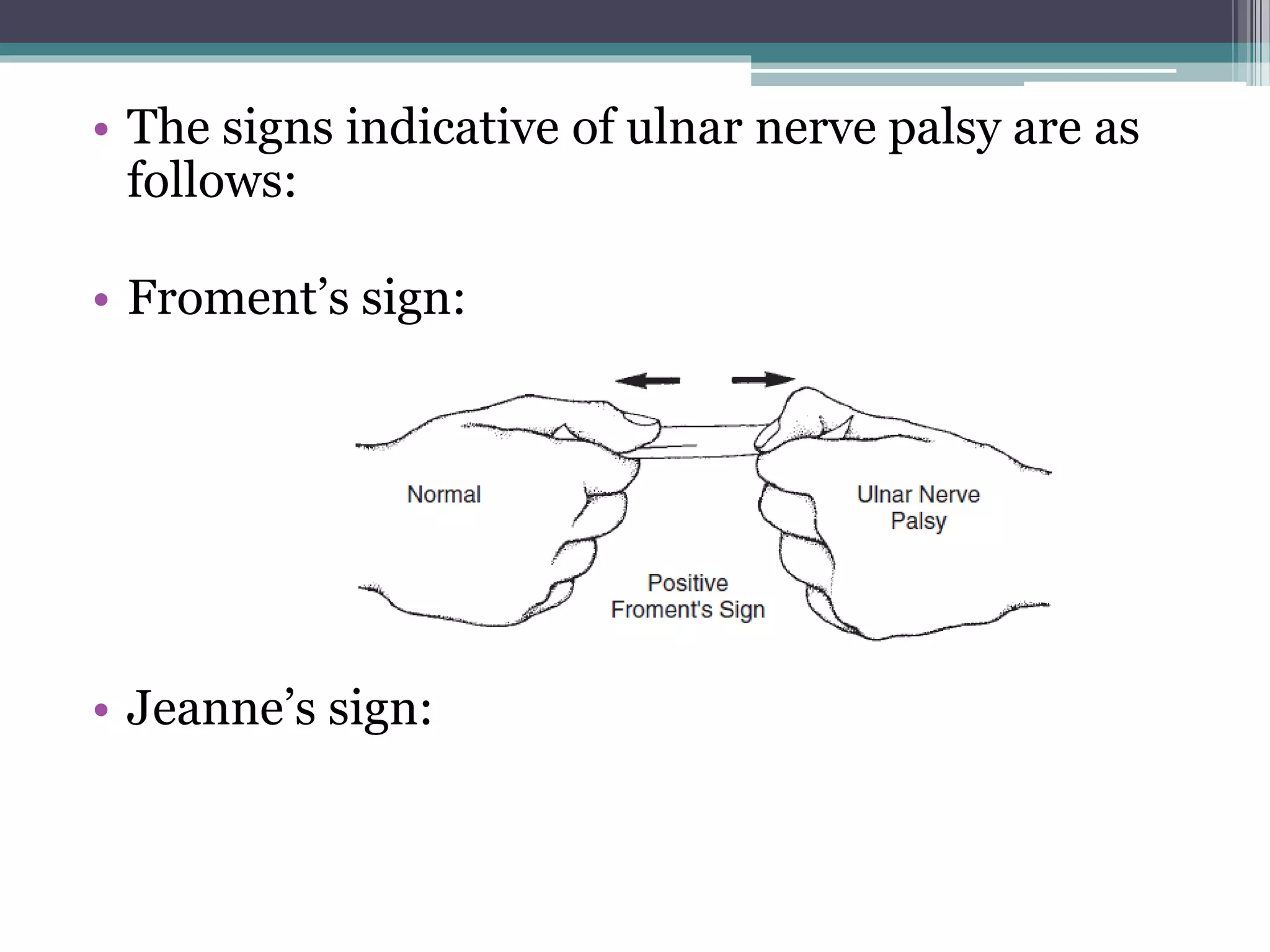 Pre and post operative management in tendon transfer | PPTX