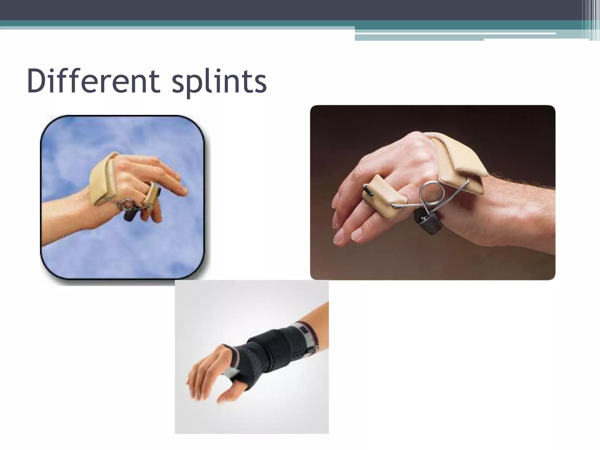 Pre and post operative management in tendon transfer | PPTX