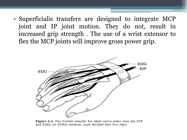 Pre and post operative management in tendon transfer | PPTX