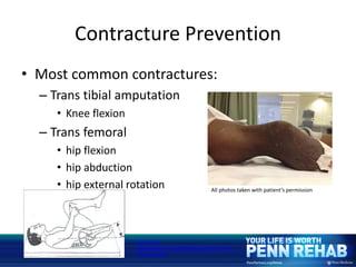 Pre and post Prostheitc reahb CG 2019.pdf