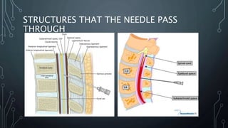 Pre anesthesia and anatomic landmarks | PPTX