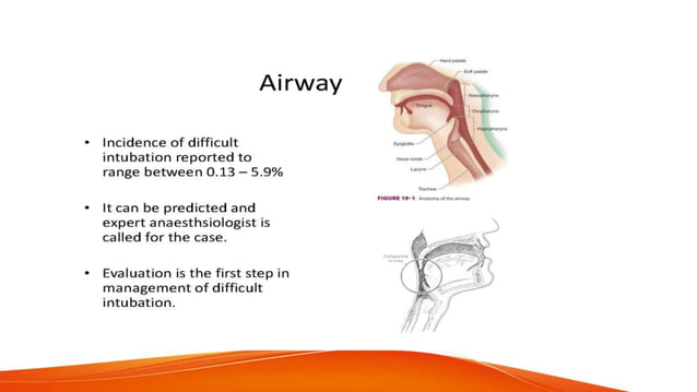 Pre anesthetic evaluation | PPTX | Heart and Cardiovascular Diseases ...