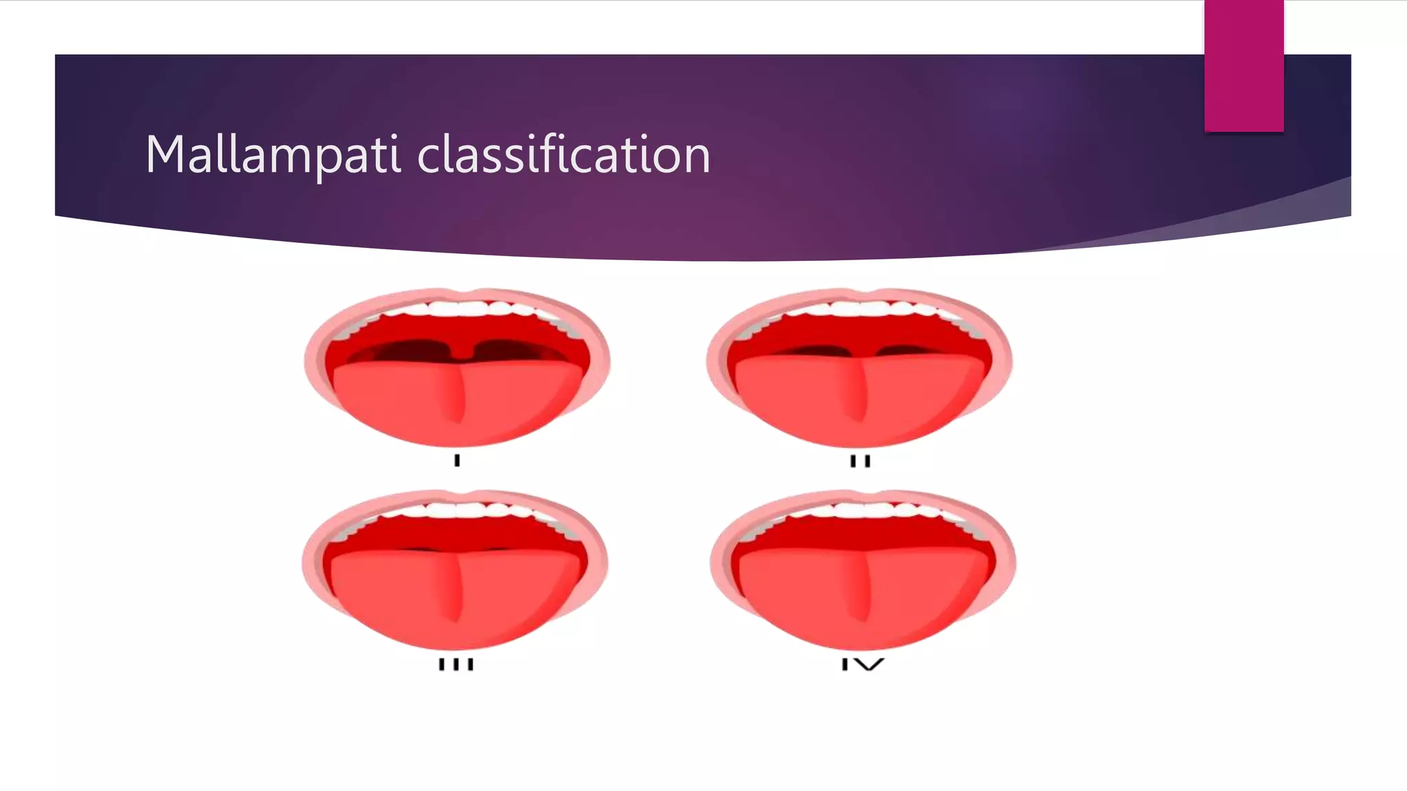 PRE ANESTHETIC EVALUATION.pptx