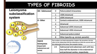 Pre-ART Management of Fibroids | PPTX