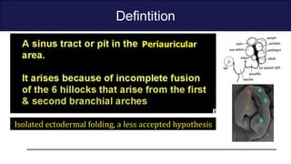 Preauricular Sinus Types ,presentstions and surgery | PDF
