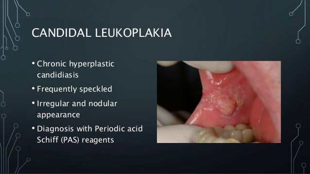 Precancerous lesions & conditions