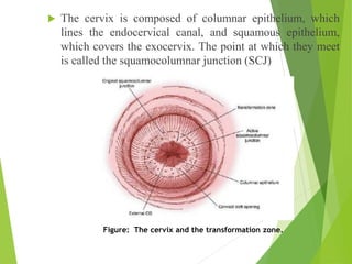 Pre cancerous lesions of cervix.pptx