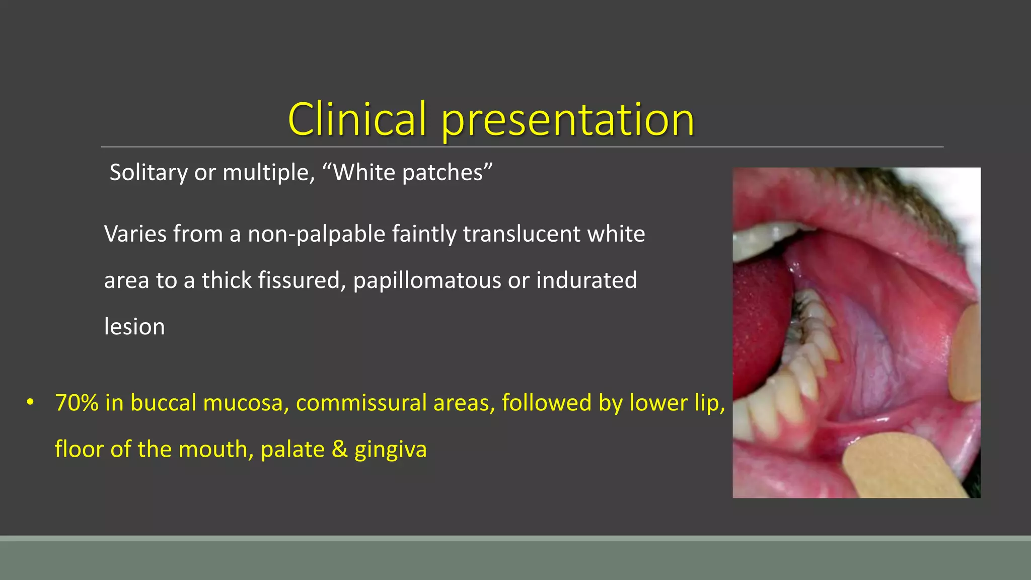 Precancerous lesions of oral cavity | PPTX
