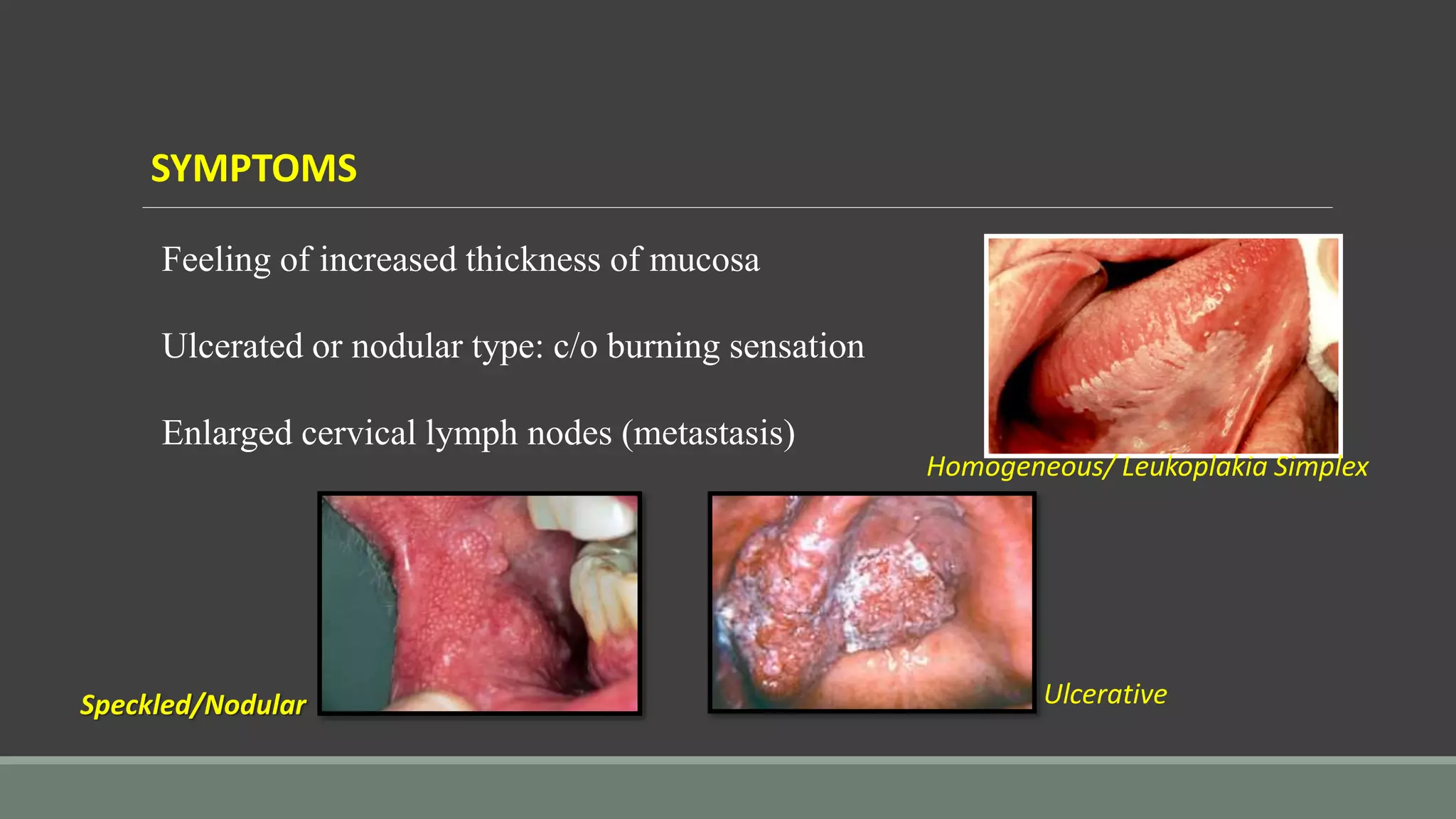 Precancerous lesions of oral cavity | PPTX