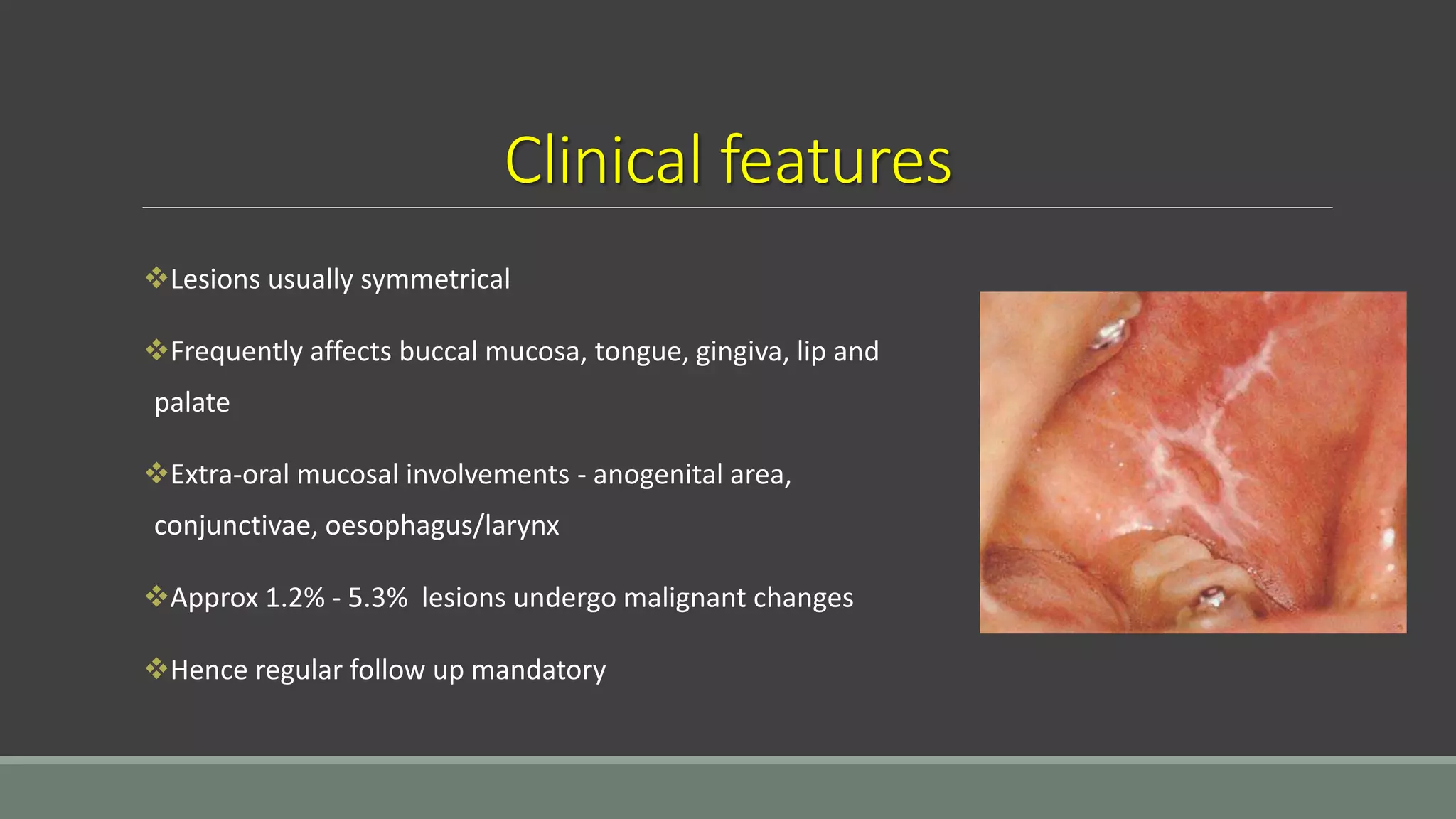 Precancerous lesions of oral cavity | PPTX