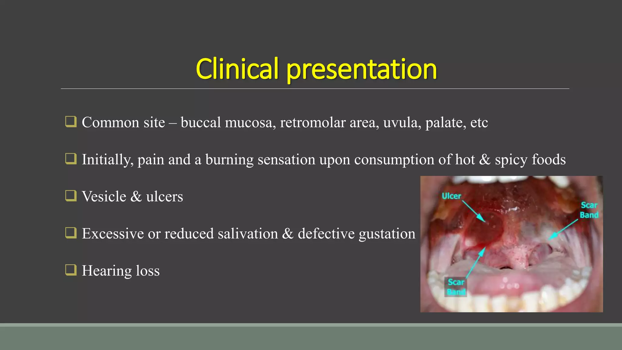 Precancerous lesions of oral cavity | PPTX