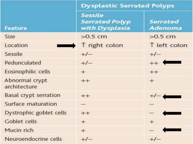 Pre cancerous colonic polyp | PPT