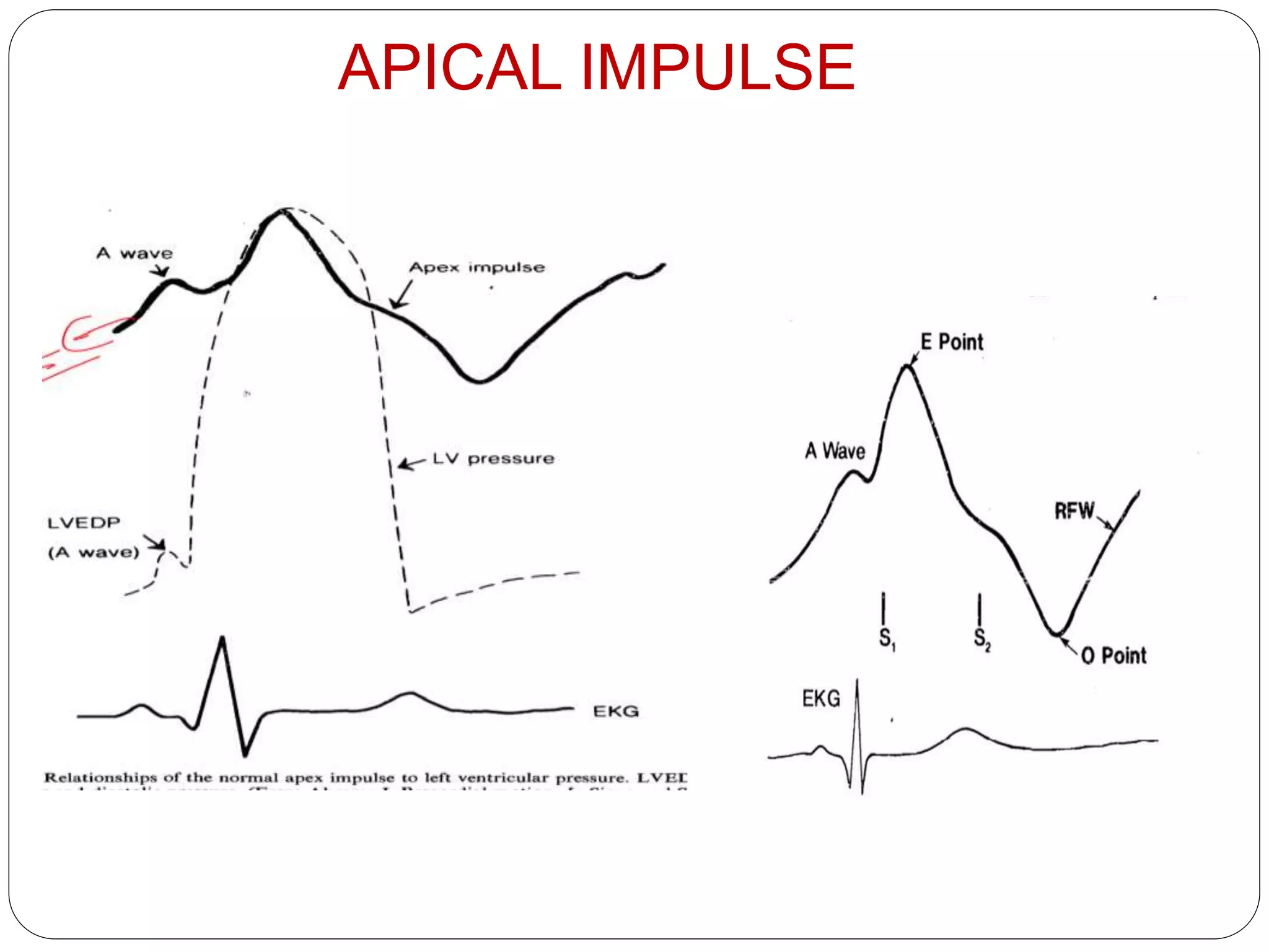Precardial examination basics | PPTX