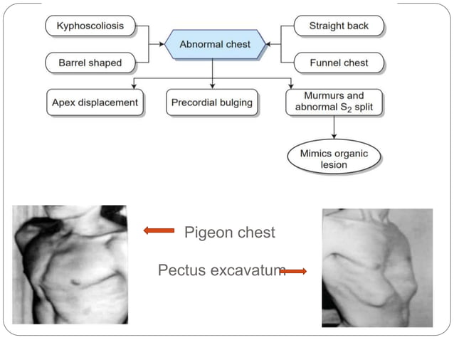 Precardial examination basics | PPTX | Heart and Cardiovascular ...