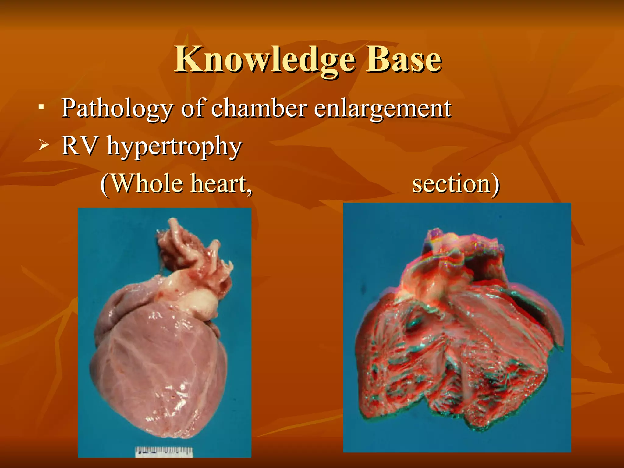 Precardium: Inspection | PPT