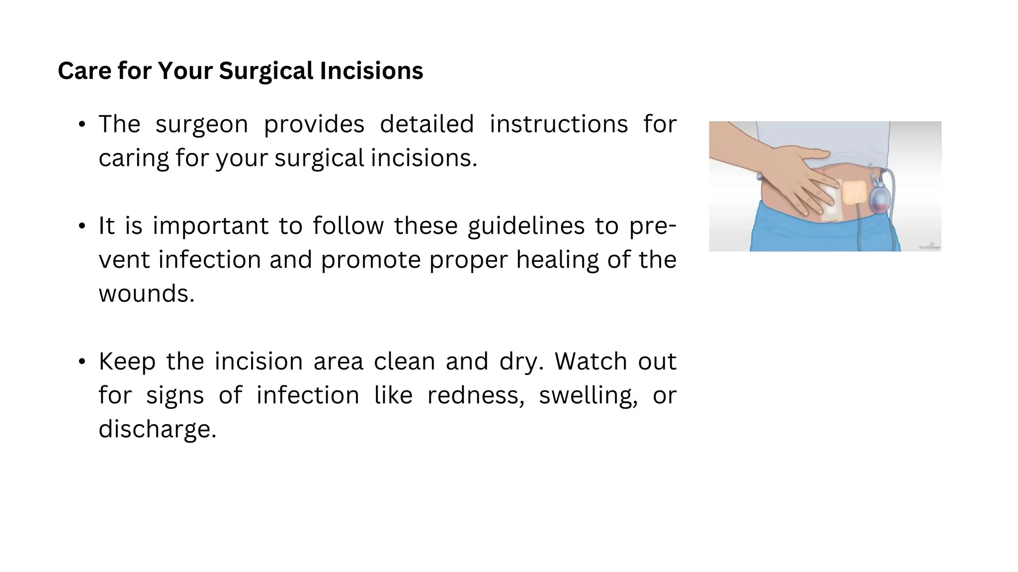 Precautions Recommended by Pristyn Care Following Hernia Surgery.pptx