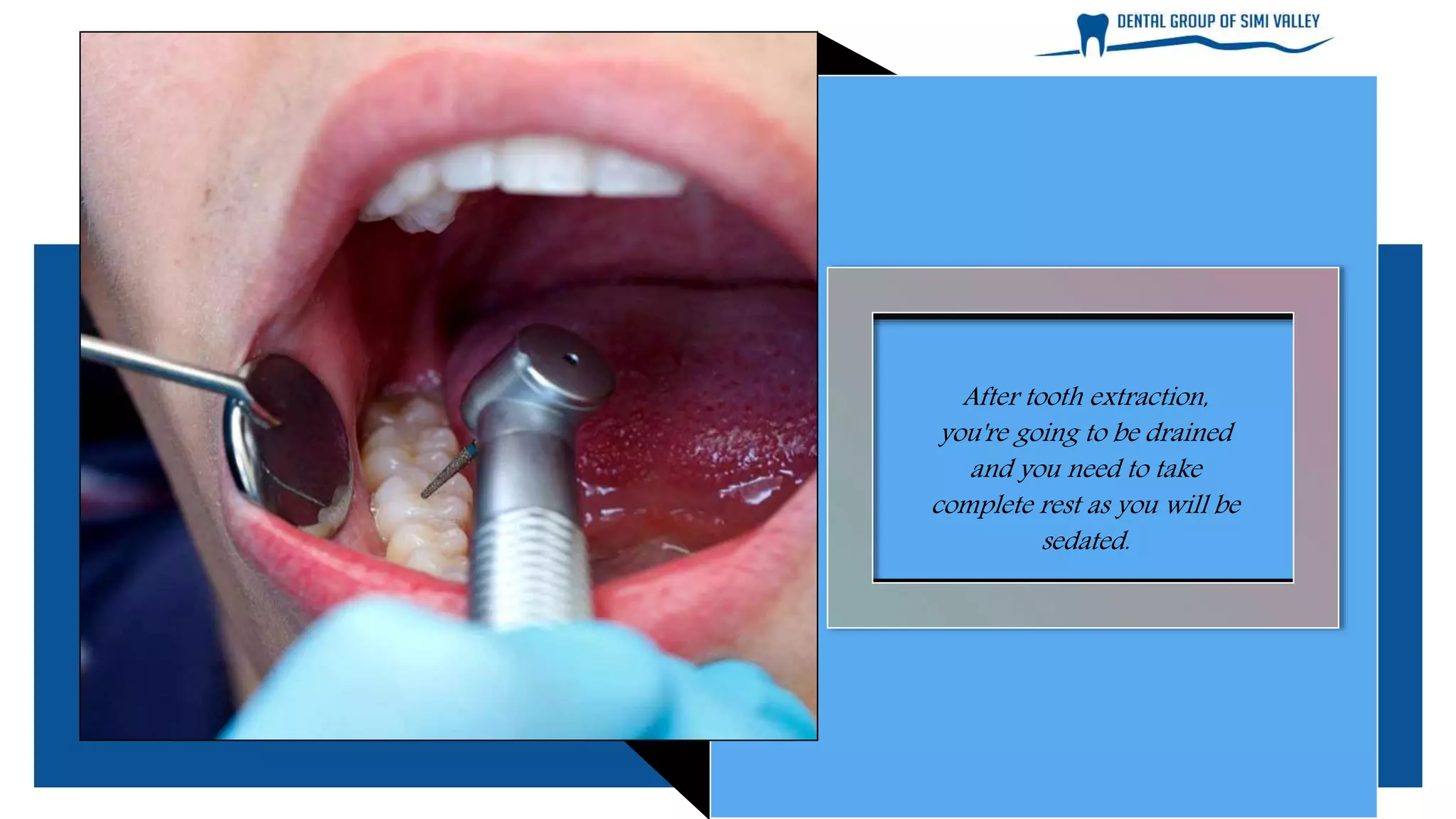 Precautions to Follow after having a Tooth Extraction | PPT