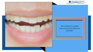 Precautions to Follow after having a Tooth Extraction | PPTX