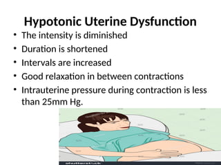 Precipitate labor.pptx incoordinate uterine actions | PPT
