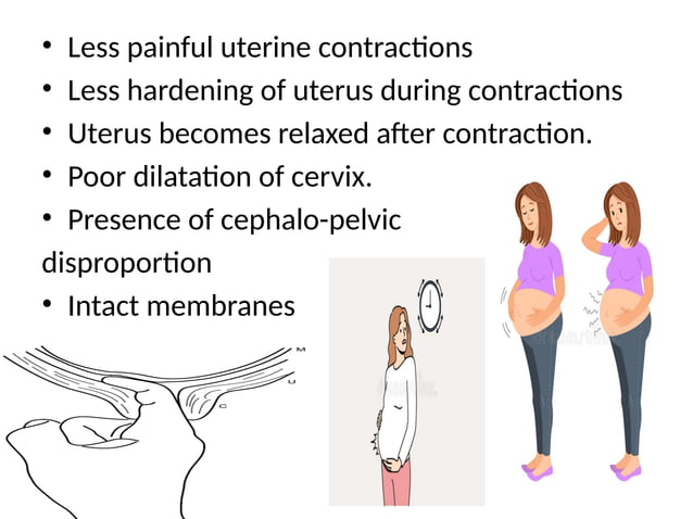 Precipitate labor.pptx incoordinate uterine actions | PPT