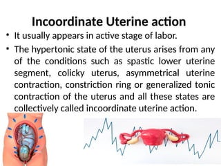 Precipitate labor.pptx incoordinate uterine actions | PPT