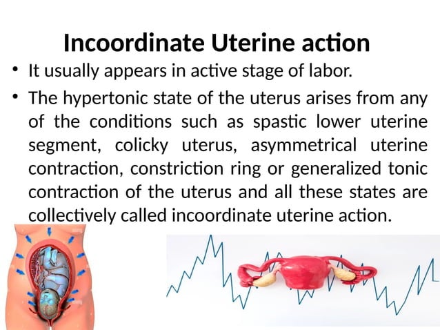 Precipitate labor.pptx incoordinate uterine actions | PPT