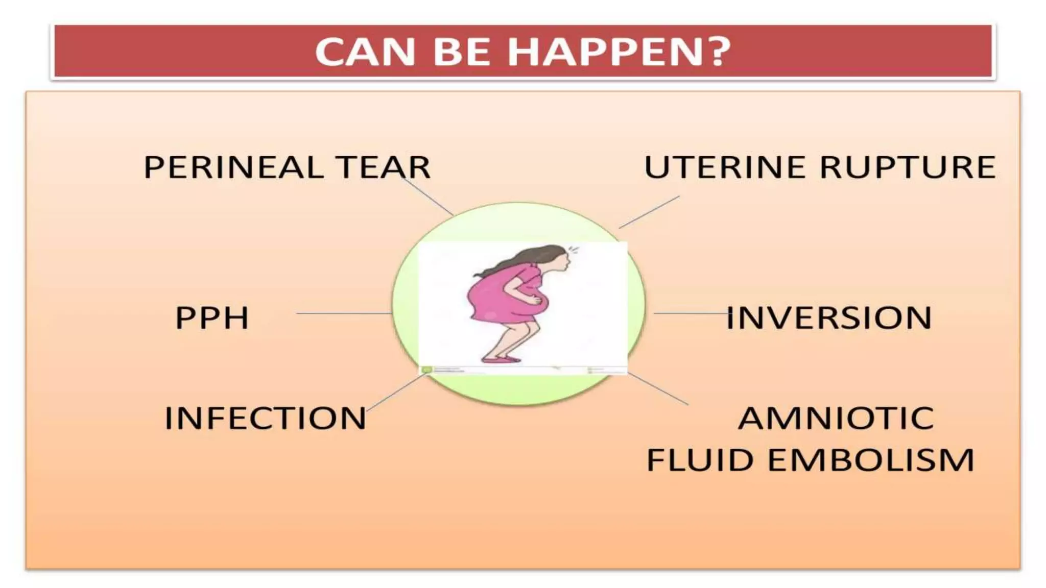 Precipitate Labour.pptx