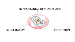 Precipitate Labour.pptx