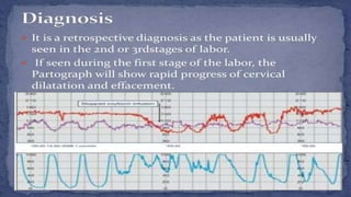 Precipitate Labour.pptx