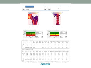 Precision and follow up scans in bone densitometry | PPTX