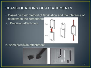 Semi Precision Attachment Abutment